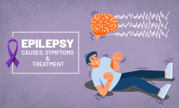 Epilepsy- Causes, Symptoms and Treatment | Accord Hospital