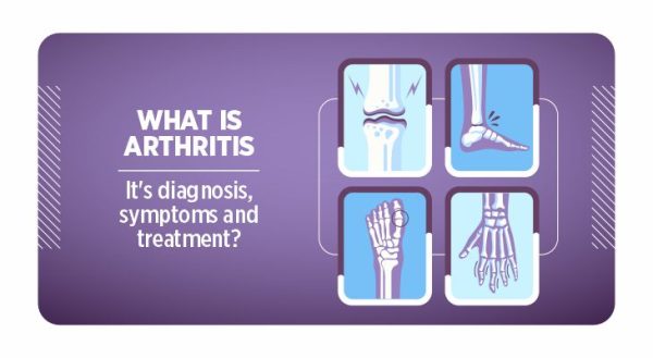 Arthritis; Diagnosis, Symptoms, & Treatment | Accord Hospital