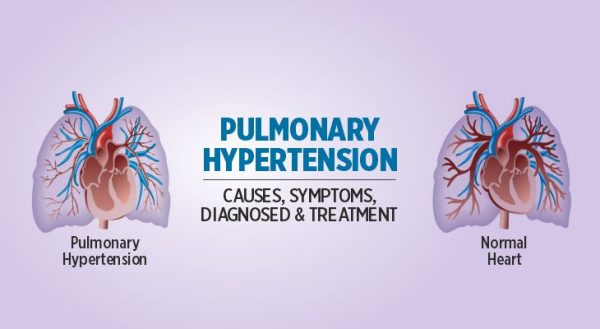 Pulmonary Hypertension Causes Symptoms Diagnosed And Treated