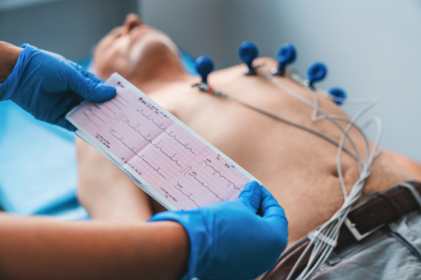 ECG vs. Echocardiogram - Understanding Differences & Benefits