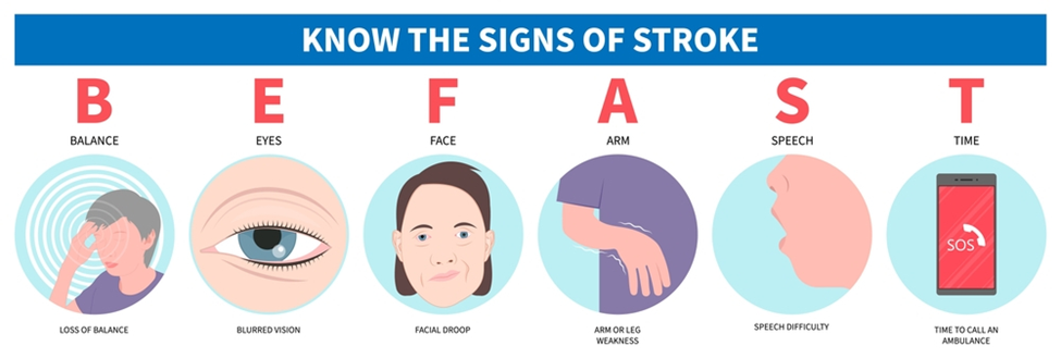 Understanding Brain Stroke; Causes, Symptoms and Treatment Management